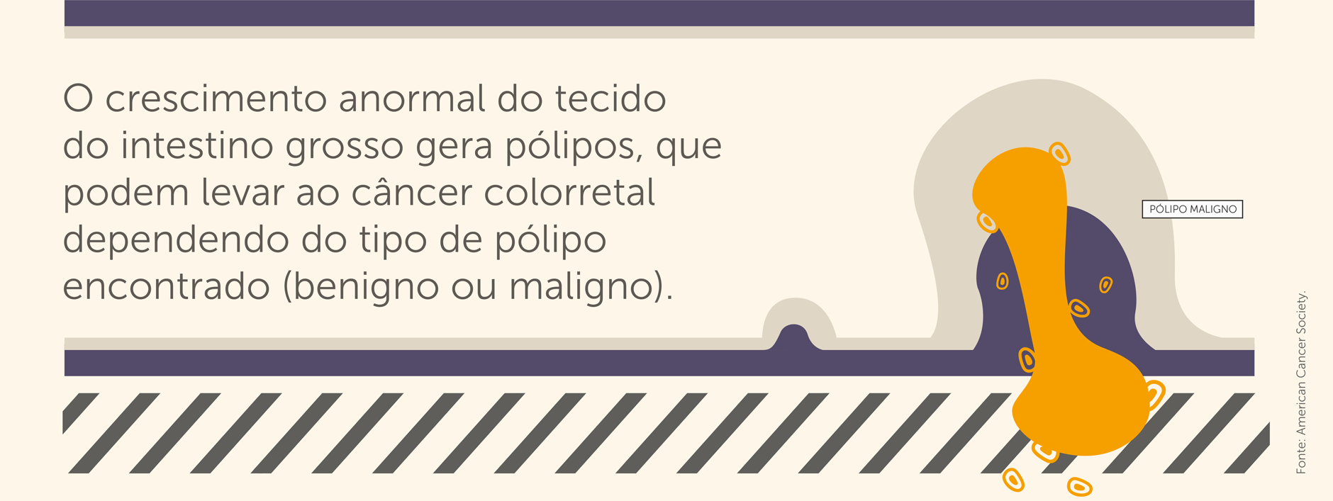 Câncer Colorretal possui prognóstico positivo – HCor